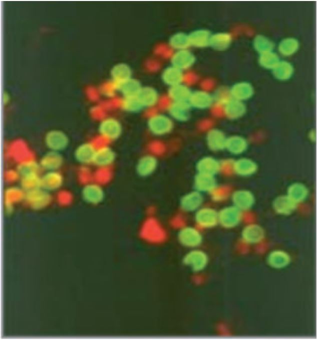 Cryptosporidium – Parasites causing diarrhoea not only in large animals ...