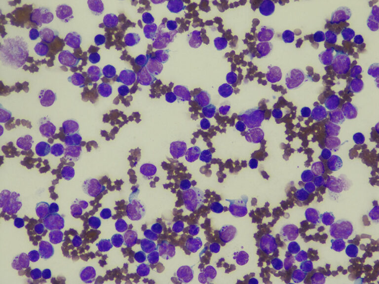 Diagnostic testing in cases of leukocytosis