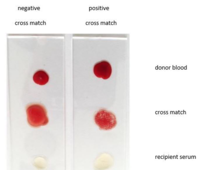 A, B, or C? New genetic tests for feline blood groups