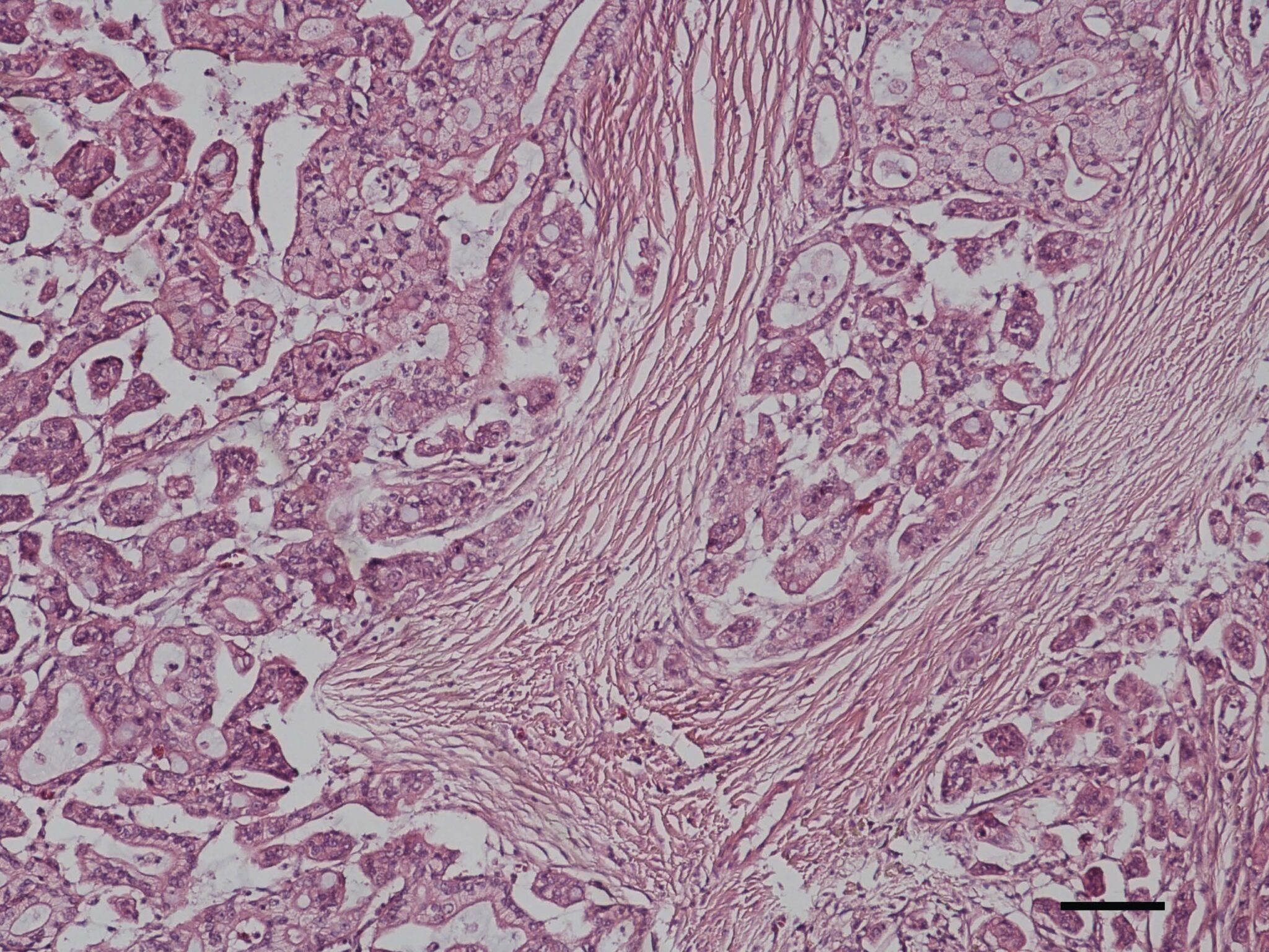 BRAF mutation in canine transitional cell and prostate carcinoma