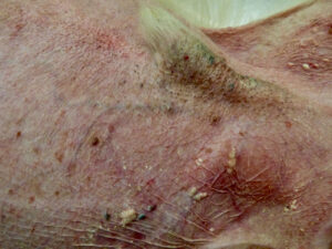 Differential diagnosis of non-inflammatory alopecia in dogs