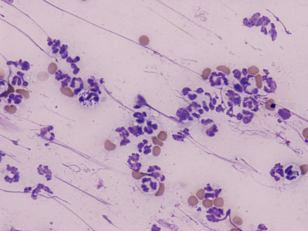 Clinical presentations of pyoderma in dogs