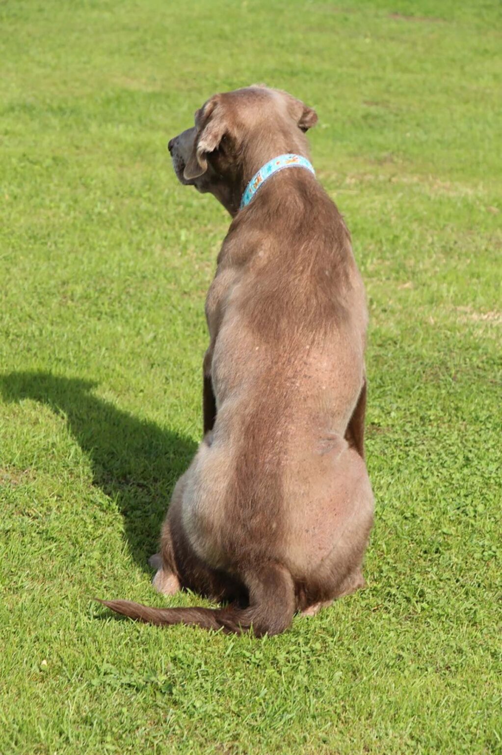 Colour Dilution Alopecia/CDA